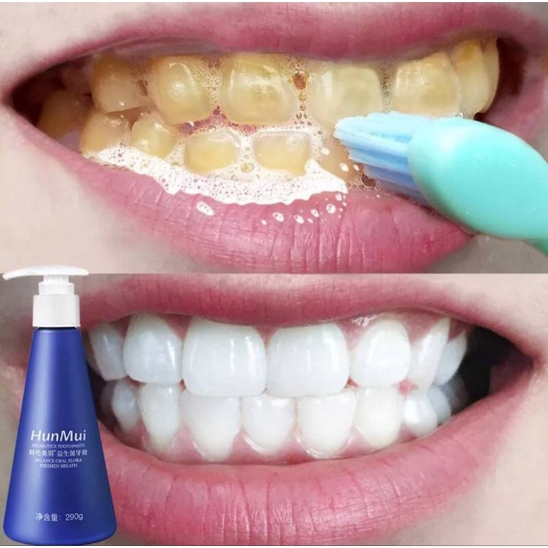 hunmui toothpaste untuk memutihkan gigi,melegakan sakit gigi,menjadikan ...