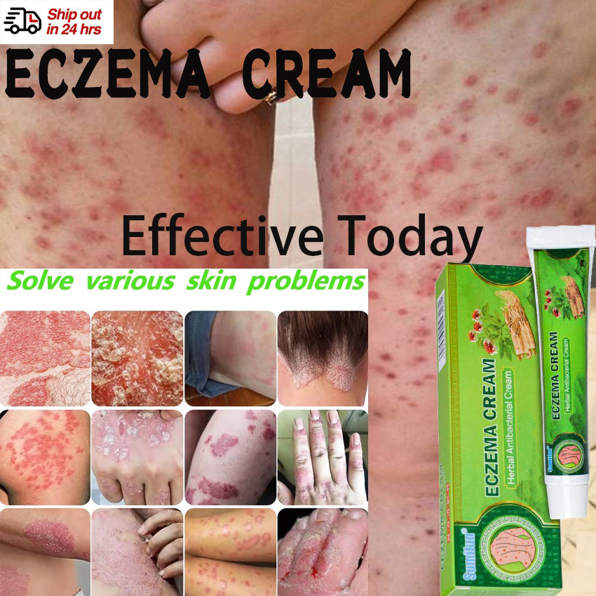 Eczema Cream Herbal Antibacterial Cream Psoriasis Itchy Skin Kudis