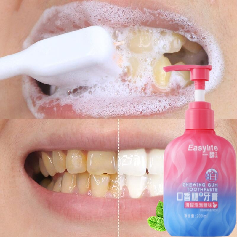 Teeth Whitening Ubat Gigi Viral Toothpaste Pemutih Gigi Toothpaste ...