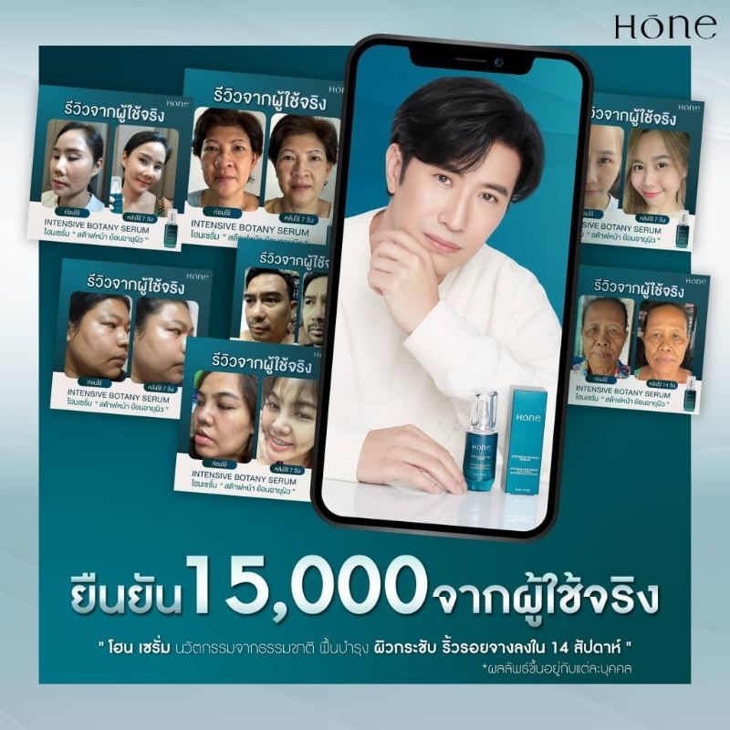 Hone Serum Facial Baby Face Korean Kornchai Beautiful smooth skin muka cantik licin 美容漂亮美丽润滑 ...