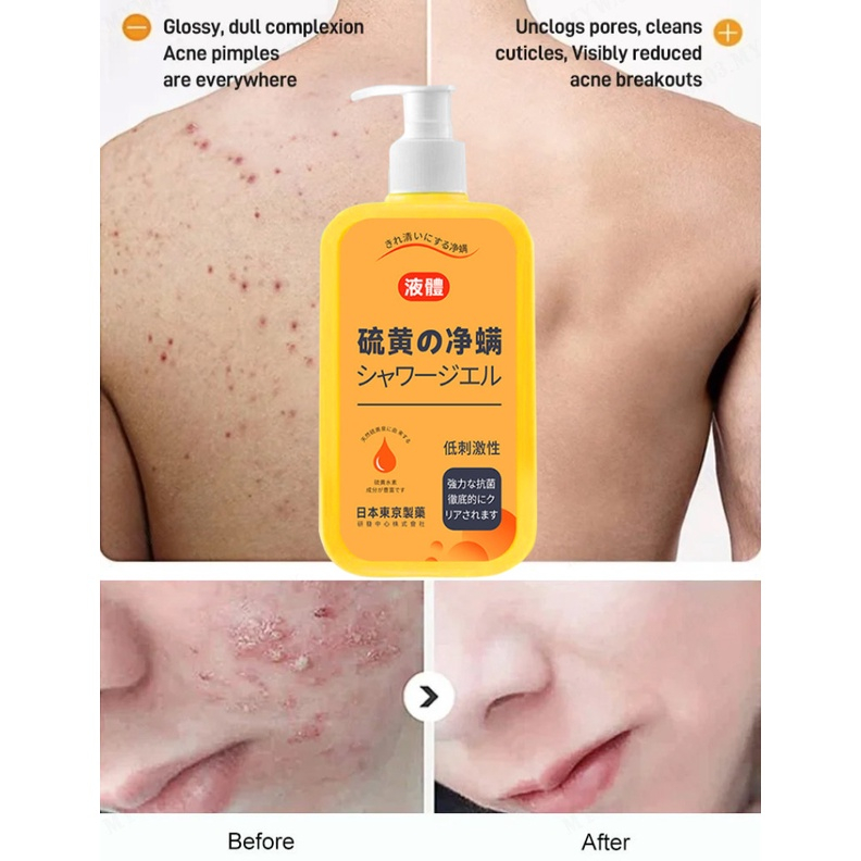 Sulfur removal mite liquid soap bath shower gel solution 300ml deep ...