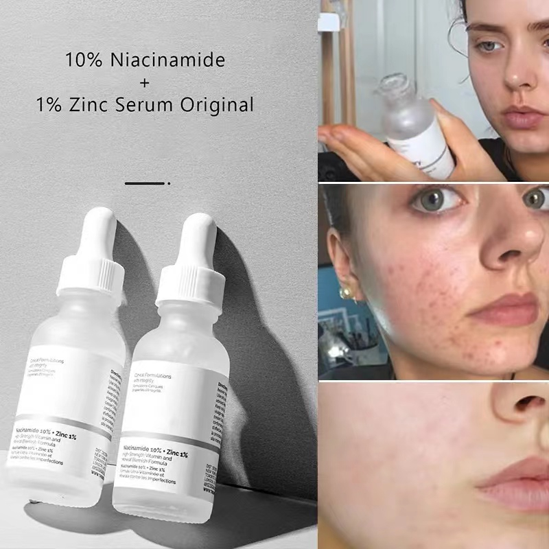 The Ordinary Best Seller Collection Niacinamide/Alpha arbutin/AHABHA ...