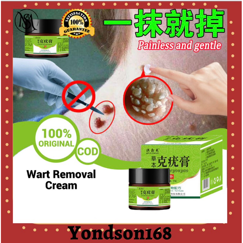 Krim ketuat gel penyingkiran ketuat /Wart Removal Wart Gel Warts cream ...