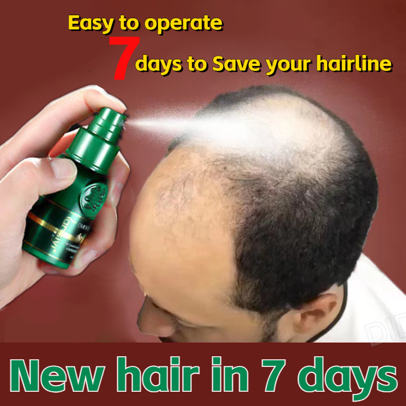 Penumbuh rambut botak Serum penumbuh rambut 50ml Hair Growth Tonic ...