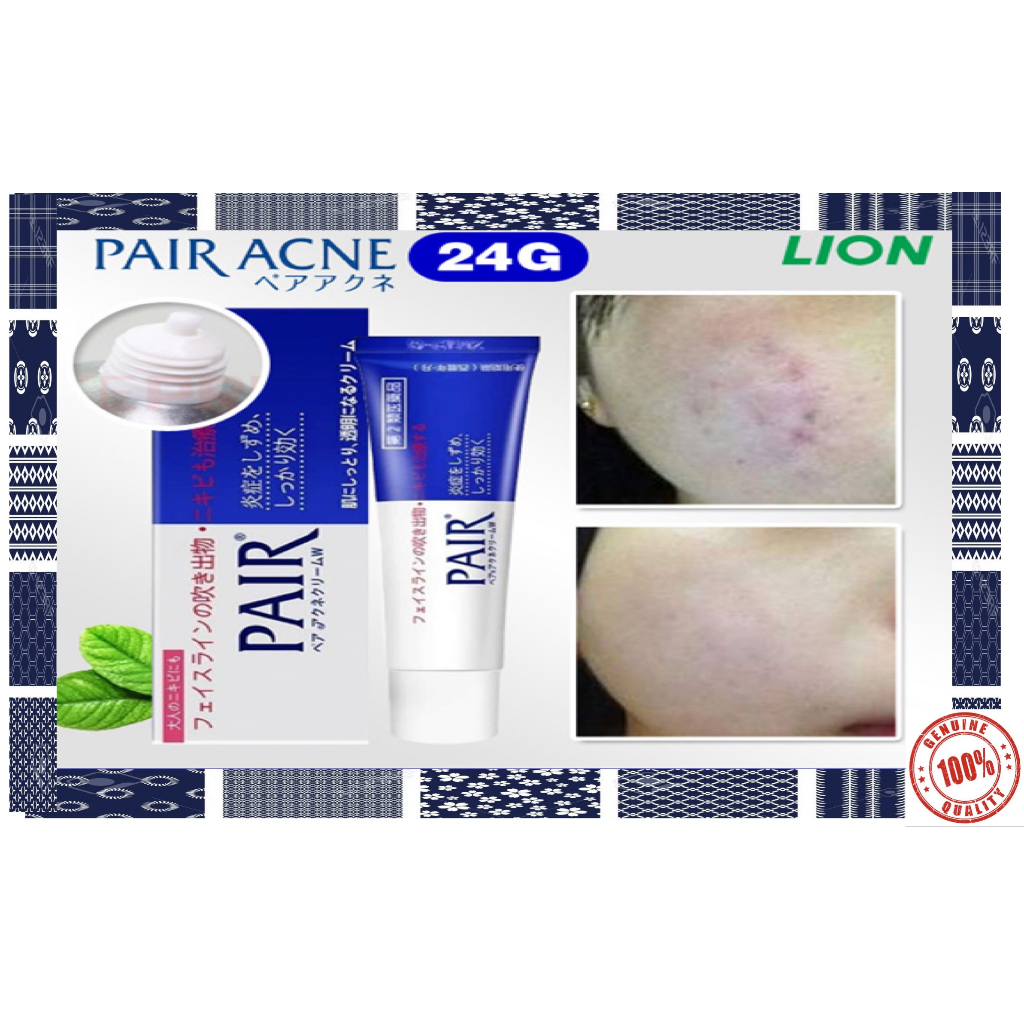 LION PAIR ACNE CREAM W 24G | Shopee Malaysia