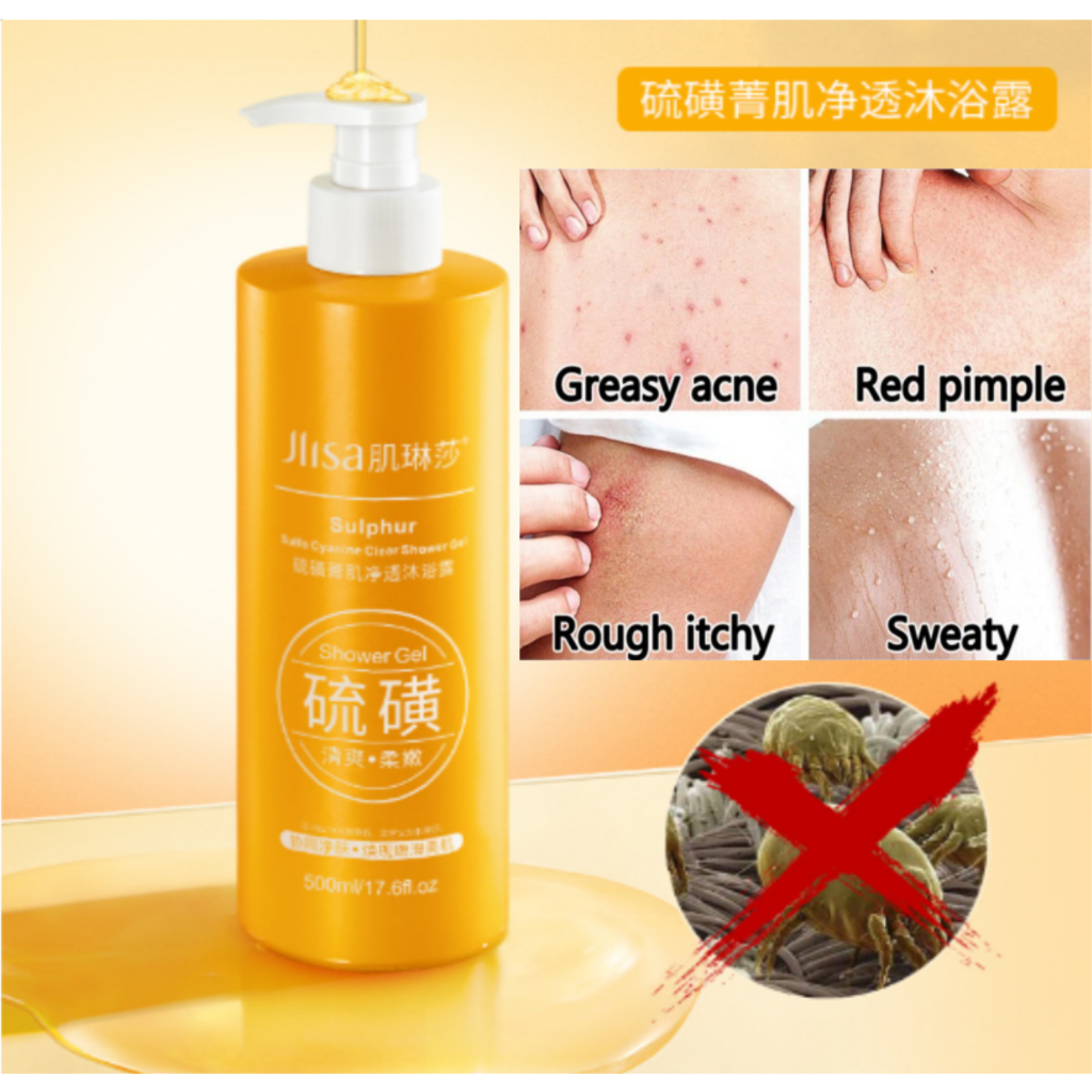 Sulfur Shower Gel 500ml For Medicated Itching Mite Removal 硫磺沐浴露 ...