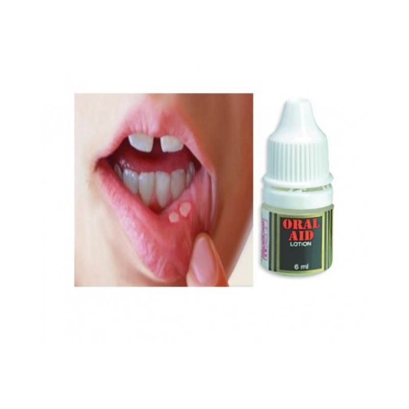 ORAL AID LOTION 6ML EXP 10/2025 ( MOUTH ULCER / SWOLLEN GUM/ TOOTHACHE ...