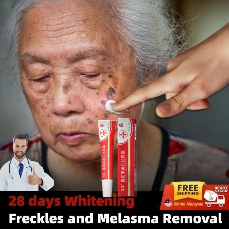 Powerful Whitening Freckle Cream Spot Removal Cream Removing Melanin ...