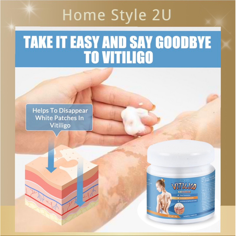 HBESTY Vitiligo cream Vitiligo treatment cream Ubat vitiligo cover ...