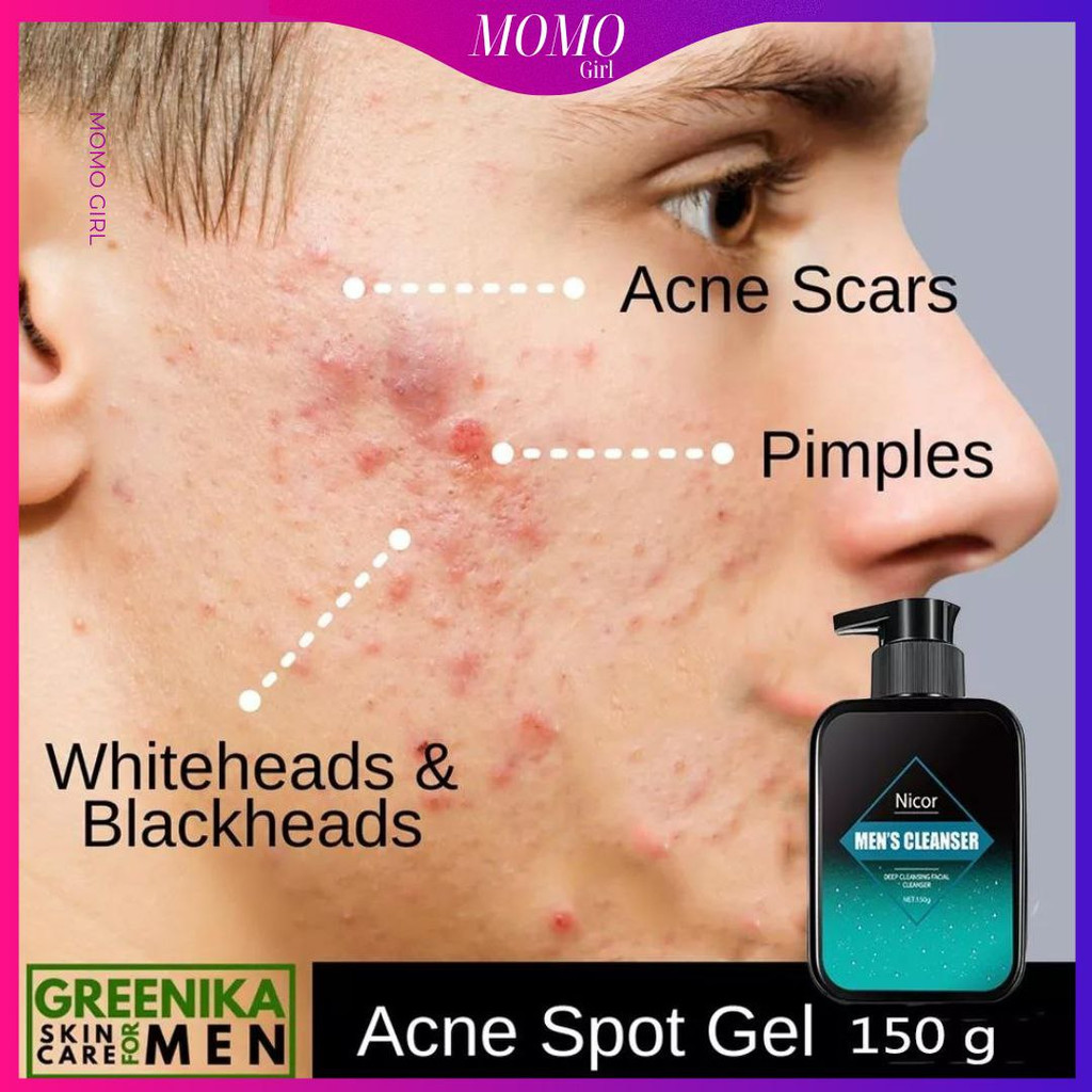 Anti Acne Facial Cleanser Nicor Men Clear Whitehead Remove Blackhead ...
