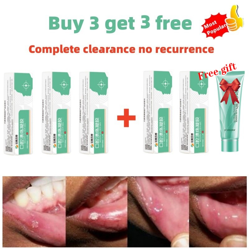 Mouth ulcer gel 20g oral ulcer inflammation antibacterial medicine lip ...