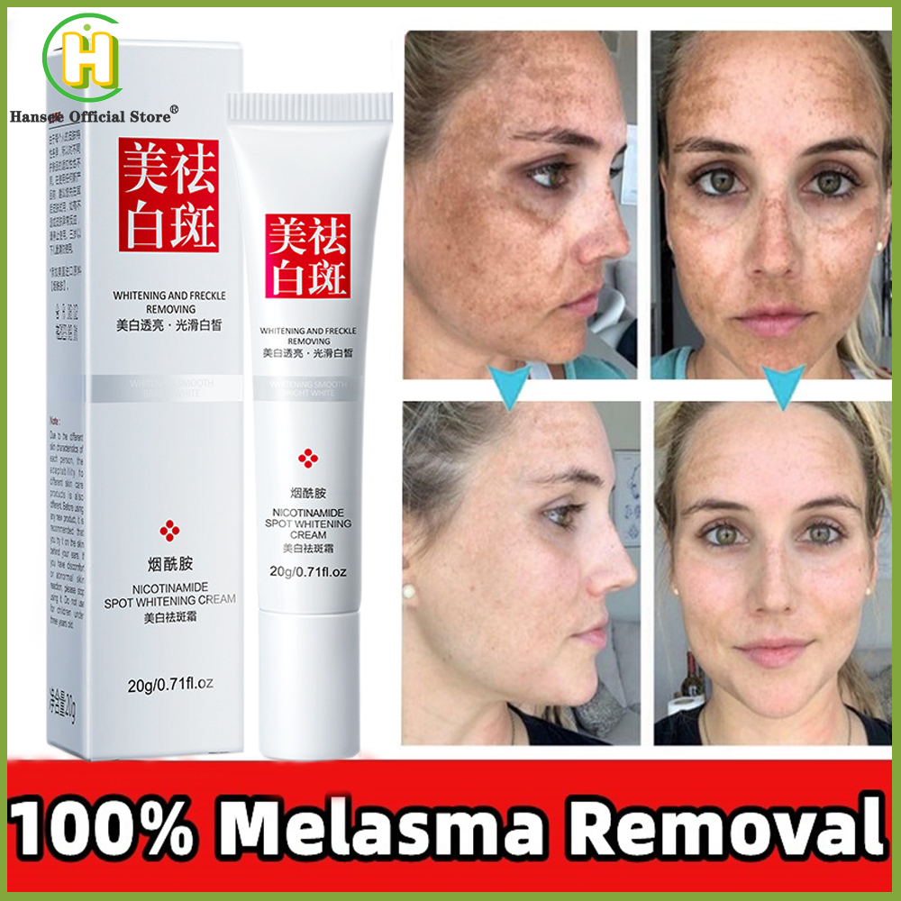 Whitening Freckle Cream jeragat treatment pigmentation cream dark spot ...