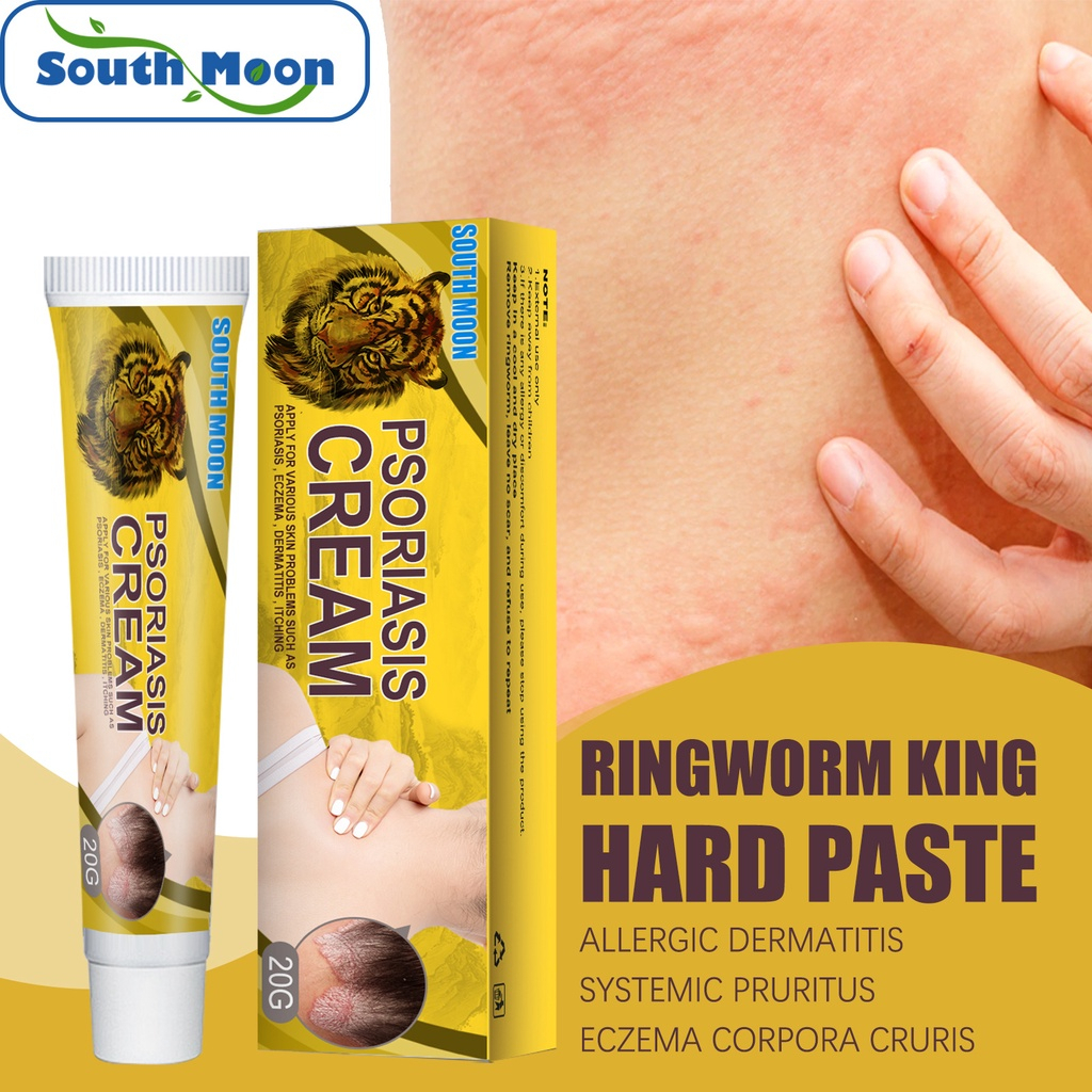 止痒膏 Psoriasis Cream eczema cream Eczema Herbal Cream Antipruritic ...