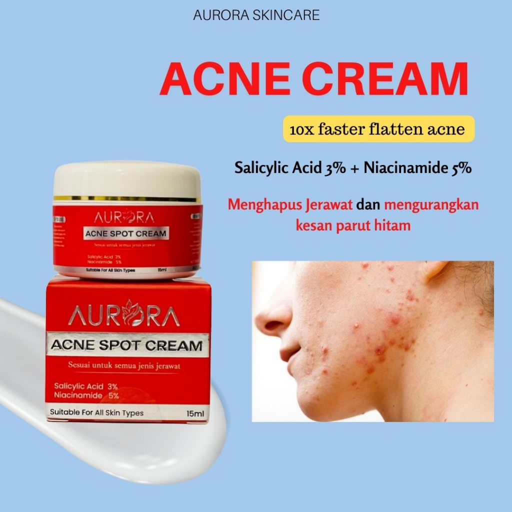 AURORA Krim Jerawat Acne Cream Ubat Jerawat Acne Spot Cream 15g ...
