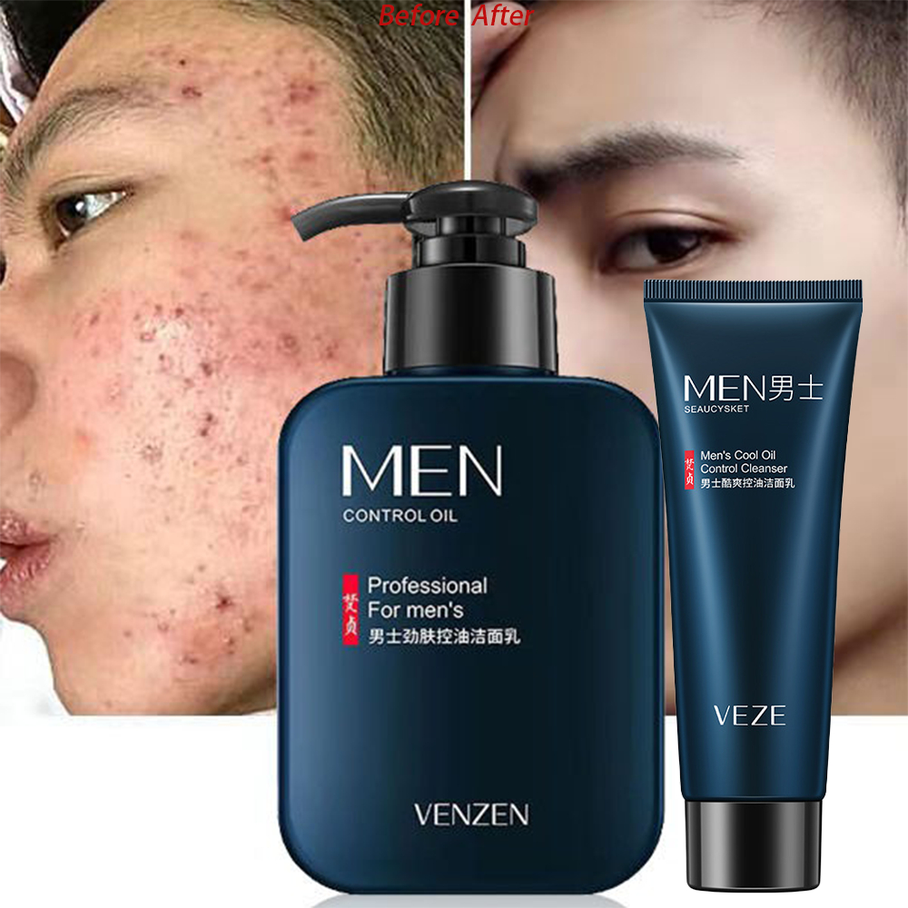 原装正品 控油祛痘洗面奶 潔面乳 Men's Oil Control Facial Cleanser face wash facial ...