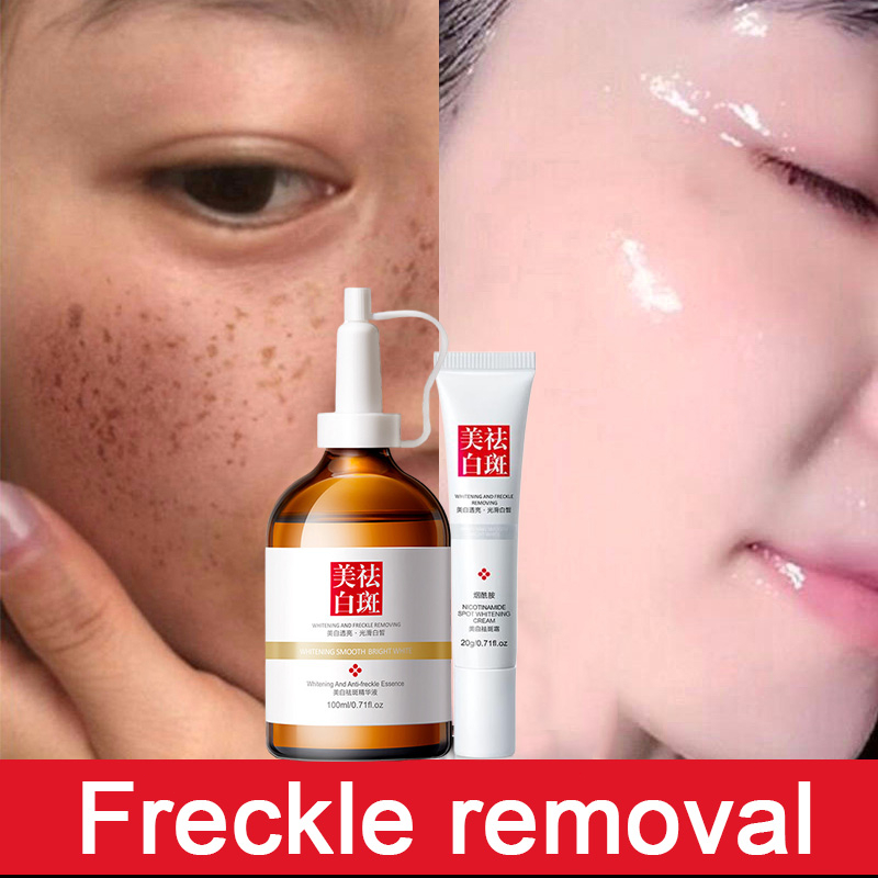 【2 Bottles of Freckle cream+Serum】Krim jeragat Freckle cream Dark spot ...