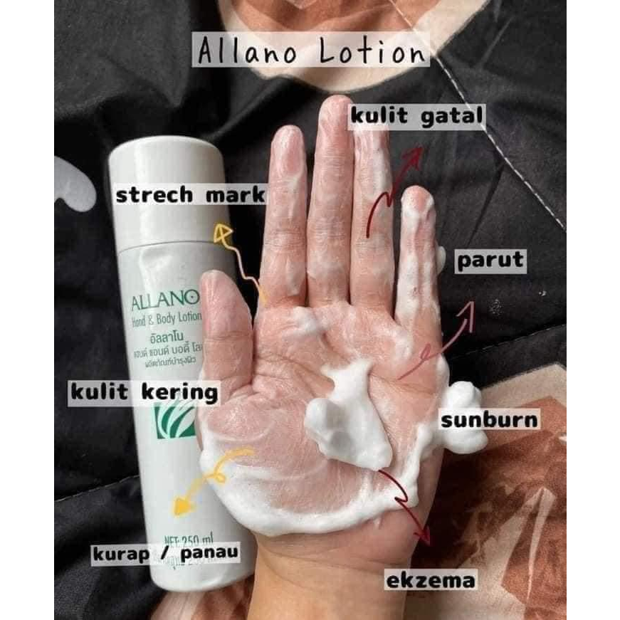 Allano Hand & Body Lotion For Semenanjung Only No Shipping For Sabah ...