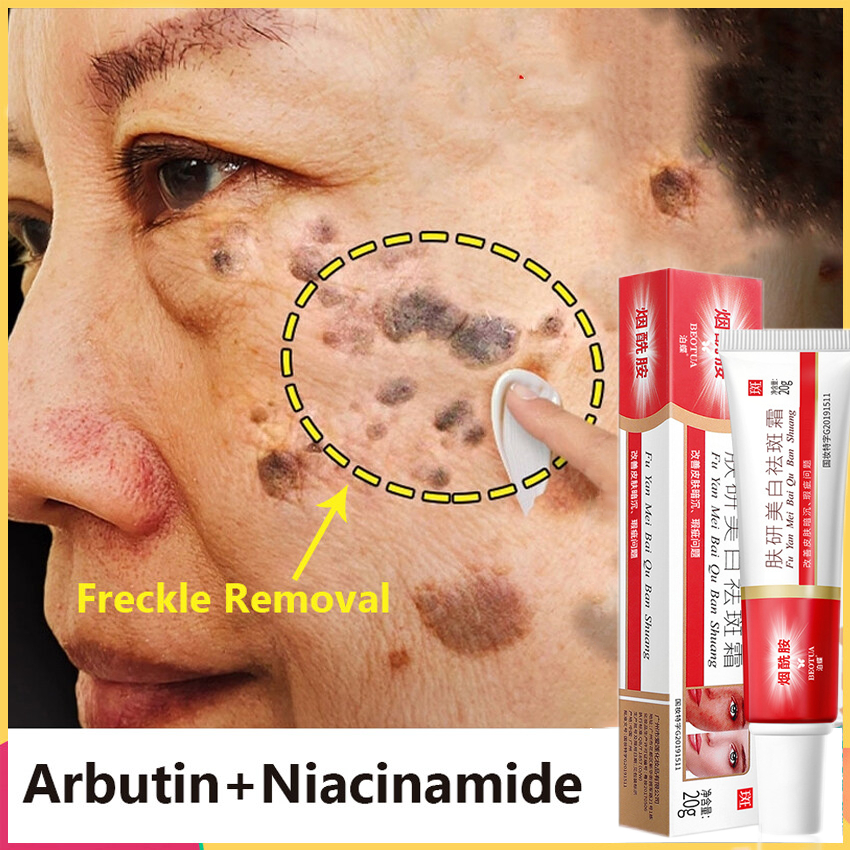 Whitening Freckle Cream Remove Melasma Acne Remove Dark Spot Cream Anti ...