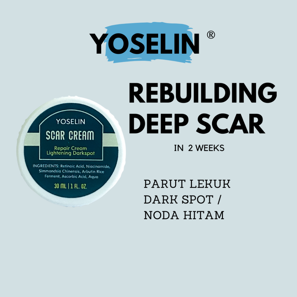 Yoselin Scar Cream Parut Lekuk Deep Ice Pick Box Scar Solution for Acne ...