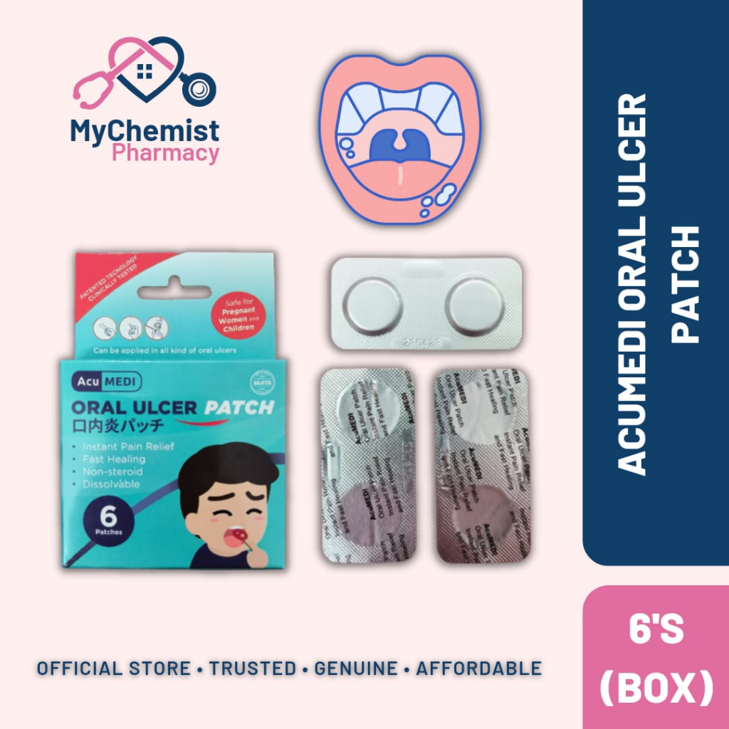 AcuMedi Oral Ulcer Patch 6's (Box) Plaster Tampal Ulser Mulut Sesuai ...