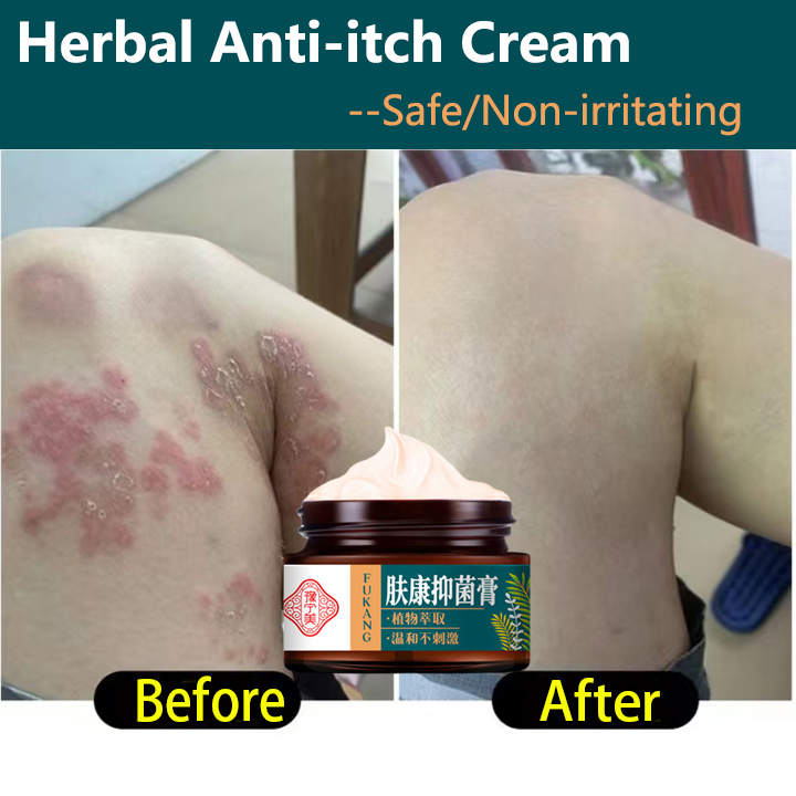 Ubat Gatal Kulit Krim Gatal Kulit Ubat Kurap Eczema Cream 30g 100% Original anti-itching ...