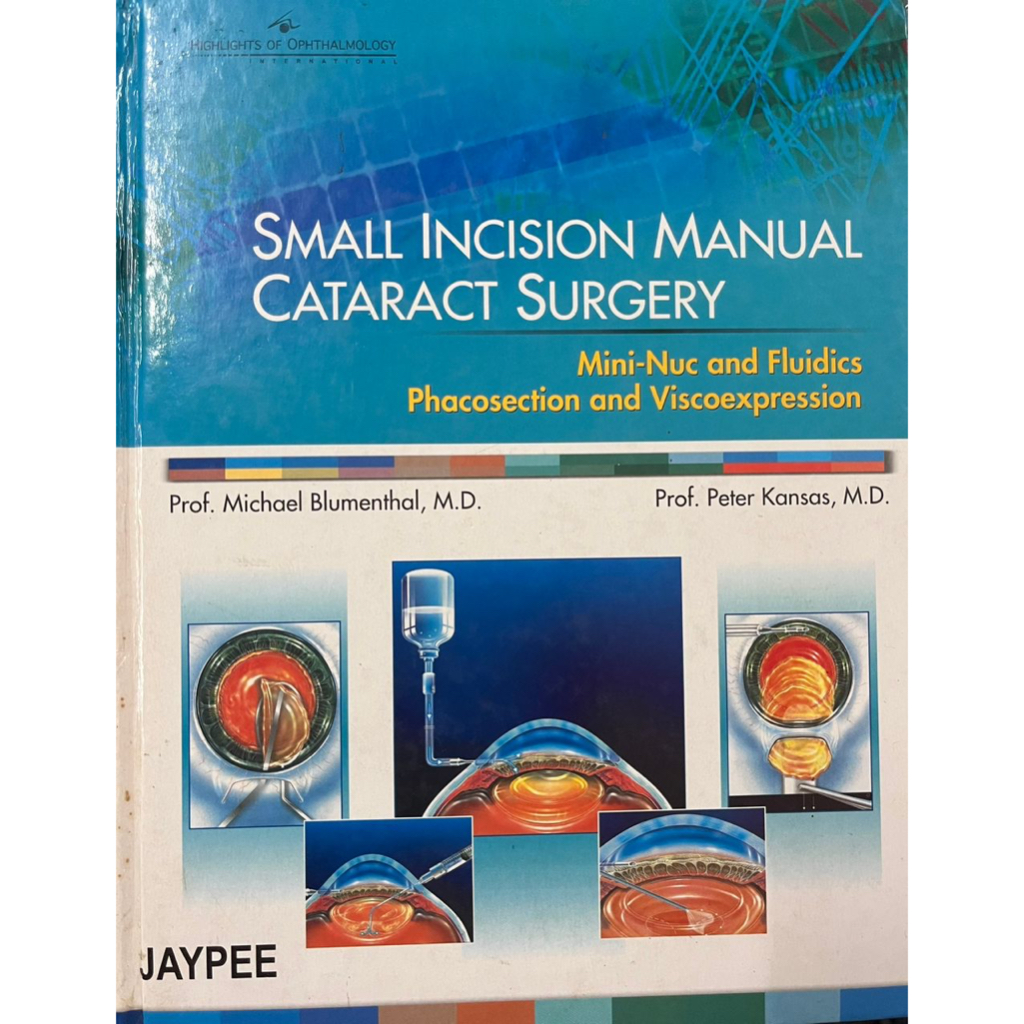 Small Incision Manual Cataract Surgery(Hard cover) | Shopee Malaysia