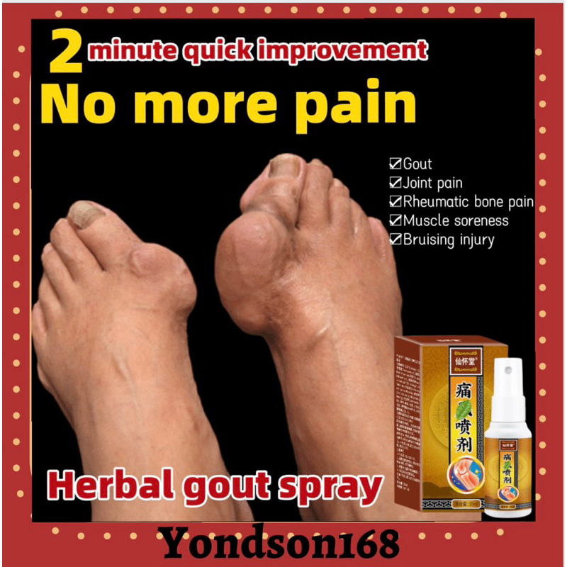 （Original）Semburan gout / Gout spray Ubat gout Ubat joint pain 30ml ...