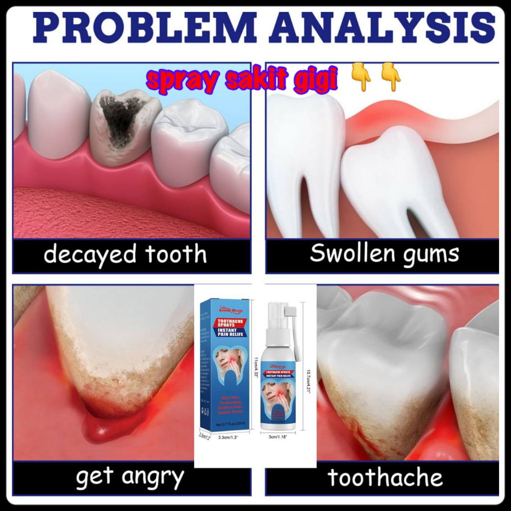 Spray Ubat Sakit Gigi Gusi Bengkak Berlubang Berkesan Gum Teeth ...