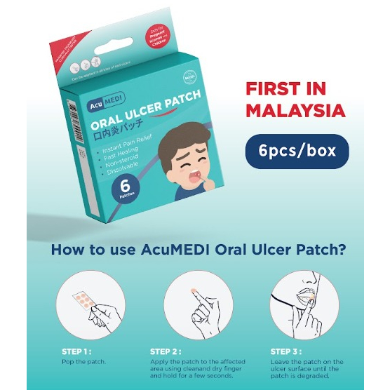 ACUMEDI Pelekat Ulser Mulut sesuai untuk ibu mengandung Oral Ulcer ...