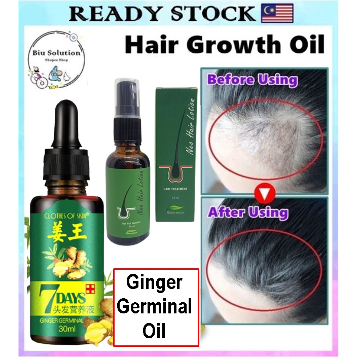 Hair Growth Ginger Shampoo Germinal Oil Essential Neo Lotion Hair Loss