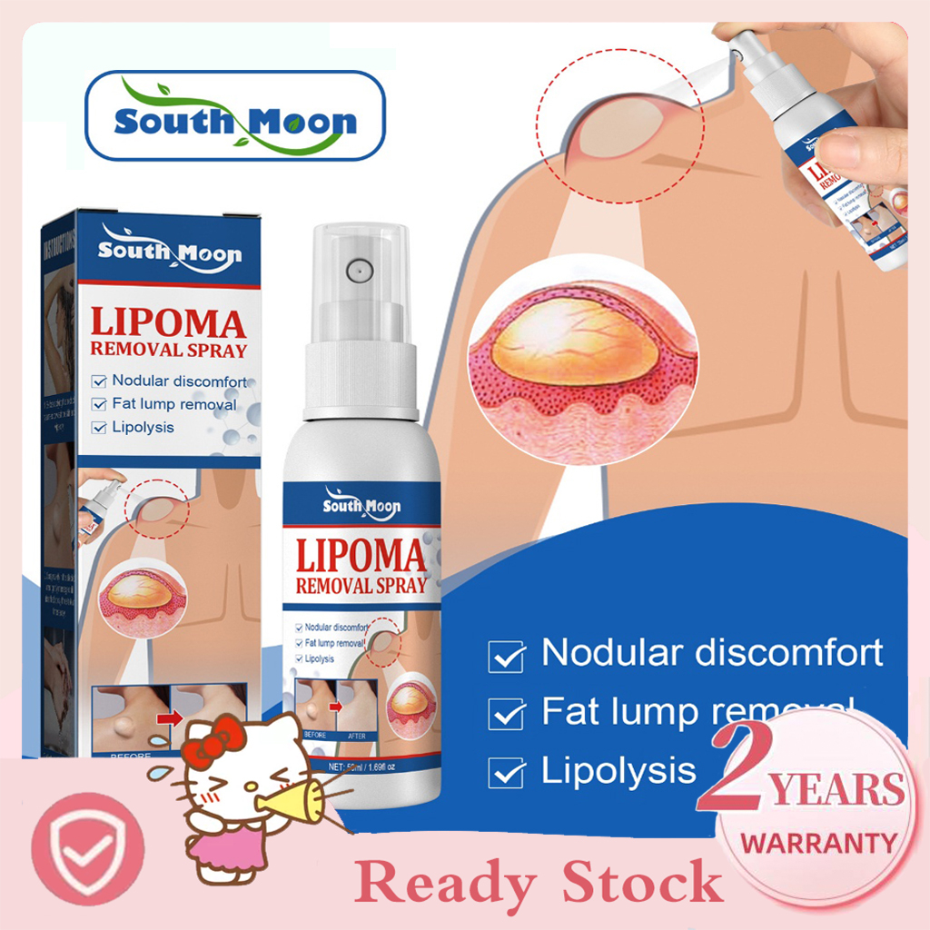 Lipoma Removal Spary Relieve body Fat Lump Tumor Subcutaneous Fat ...