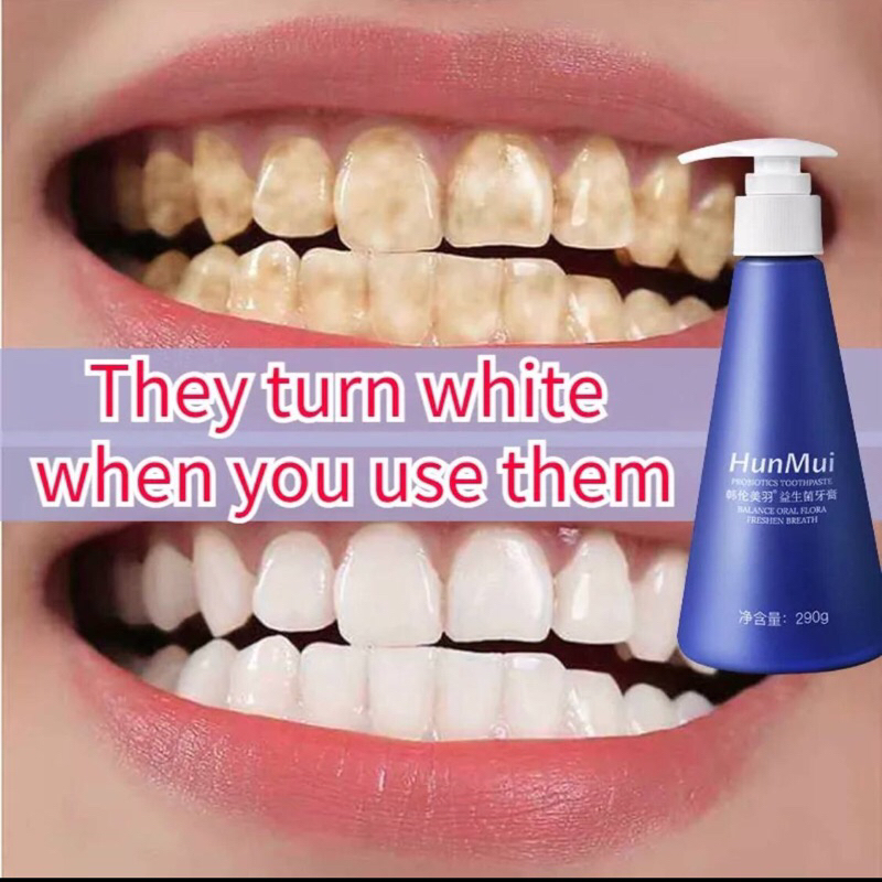 HUNMUI PROBIOTIC TOOTHPASE Ubat Putih gigi hilangkan karang gigi ...