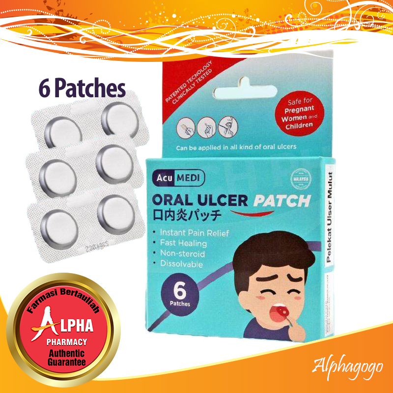Oral Ulcer Patch (Acu MEDI) 6 Patches | Shopee Malaysia