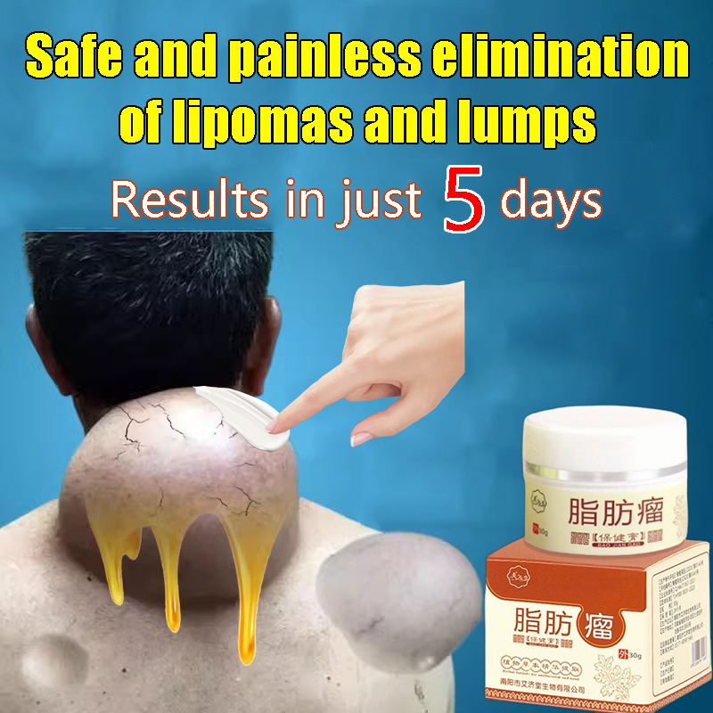 [Original] Lipoma cream Lipoma removal cream 30g Fast remove ...