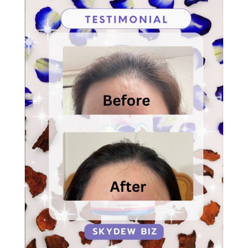 Skydew Flower Shampoo Bunga Telang Shampoo He Shou Wu Pea Protein Hair ...