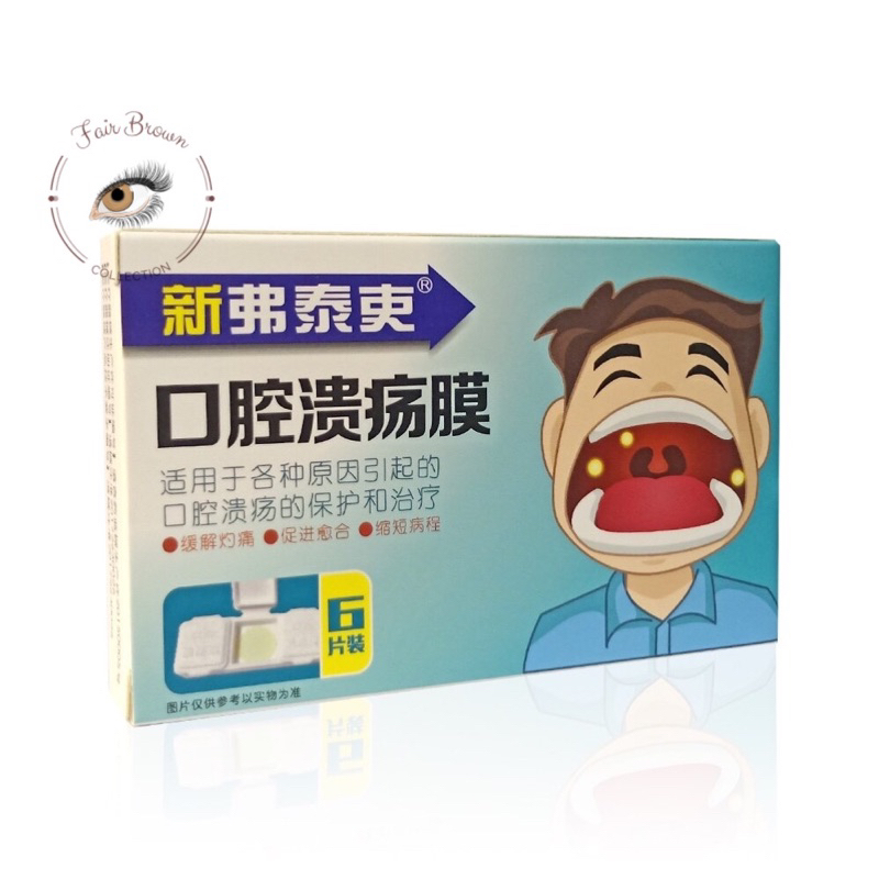 (READY STOCK) Oral Ulcers 1 box Relief Severe Pain Irritation Canker ...