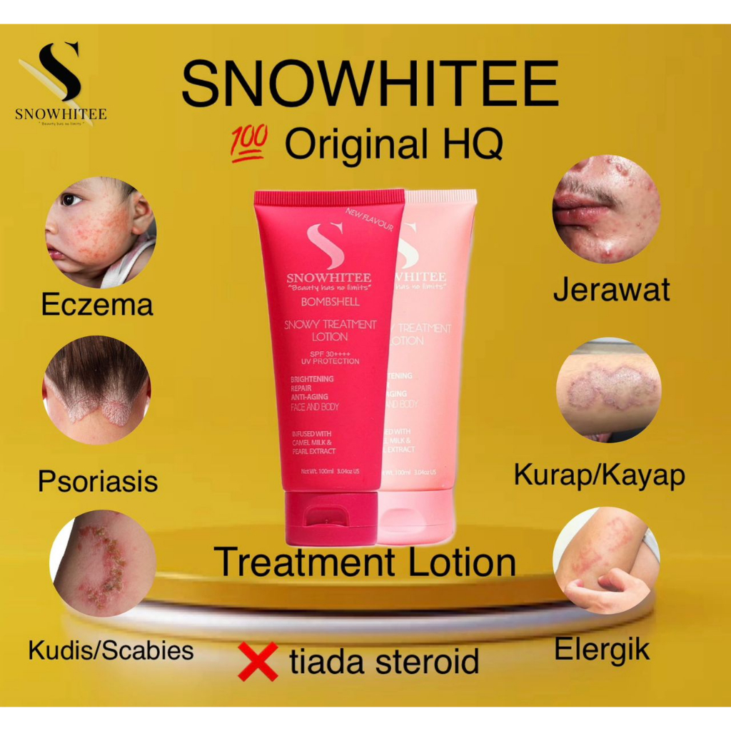 Pick Me🔥Snowy Treatment Original🔥 Krim gatal kulit eczema, elergik ...