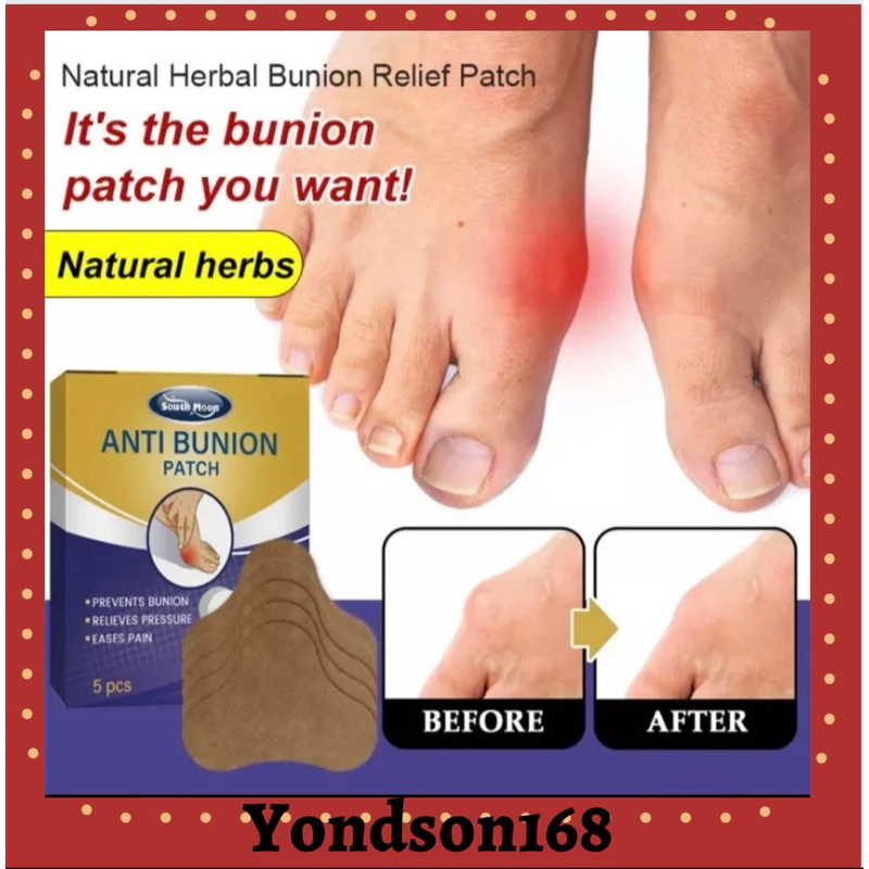 Natural Herbal Medicine Bilitis Patches Anti Bunion Patch South Moon 抗拇 ...