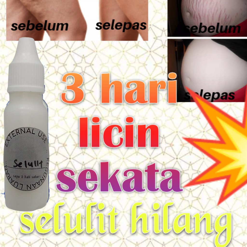 krim selulit berkesan untuk lelaki dan perempuan,selulit perut,selulit ...