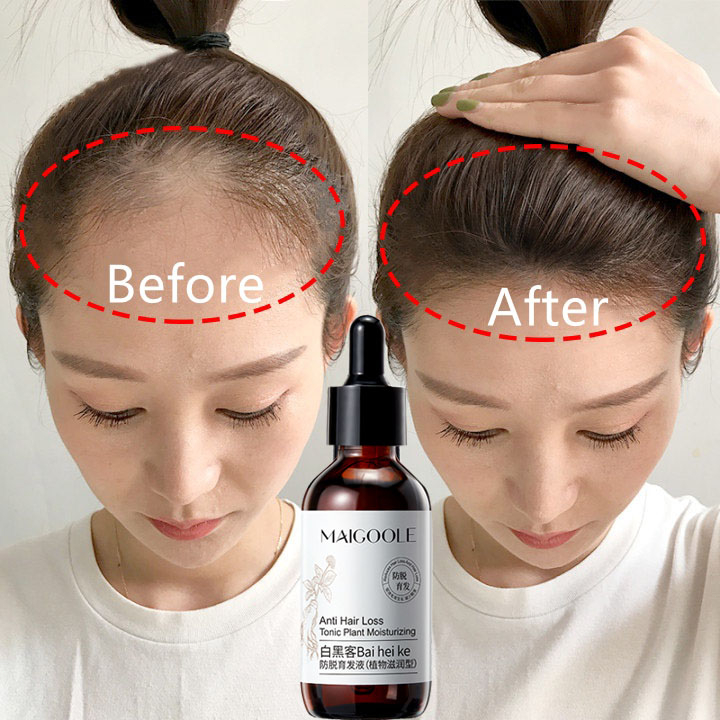 Hair Growth Serum Fast Hair Growth Oil 60ml Anti Hair Loss Serum Growth ...