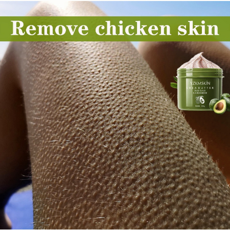 body scrub whitening scrub exfoliate remove chicken skin Moisturize ...