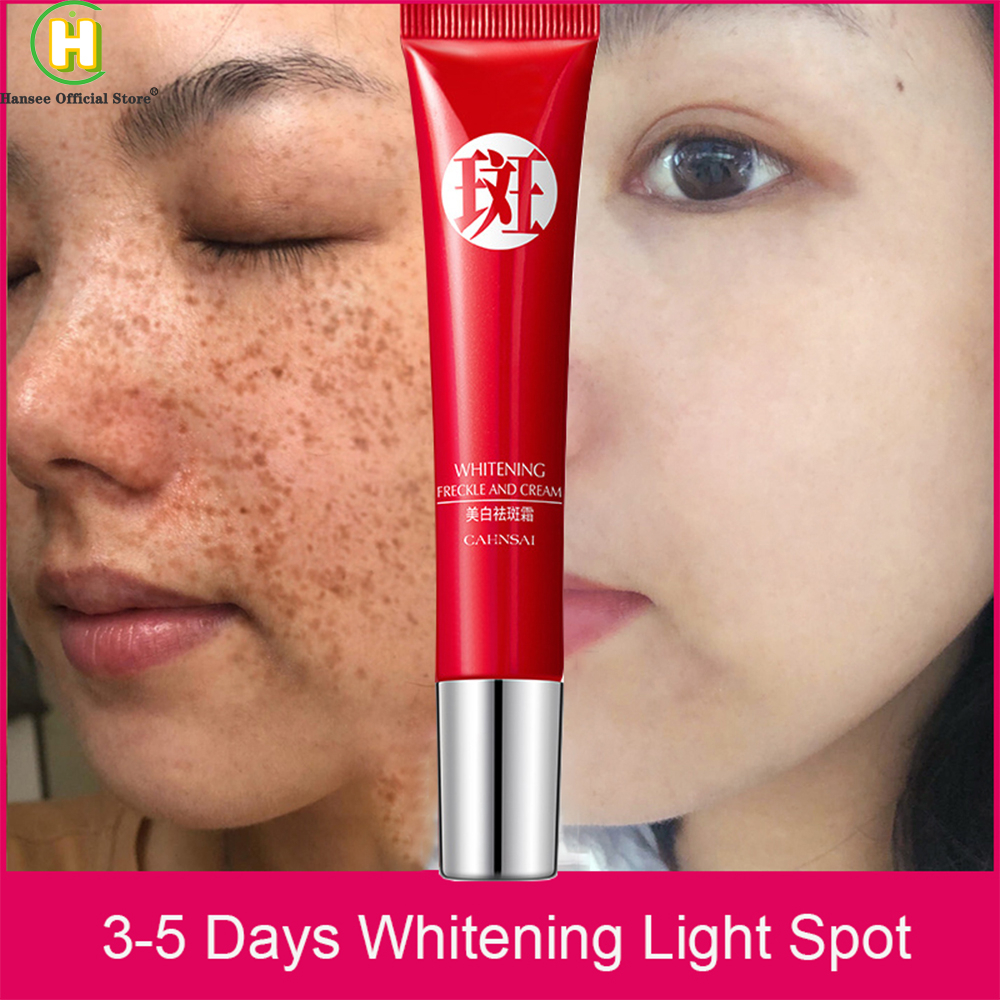 freckle cream krim jeragat freckles removal cream dark spot remover ...