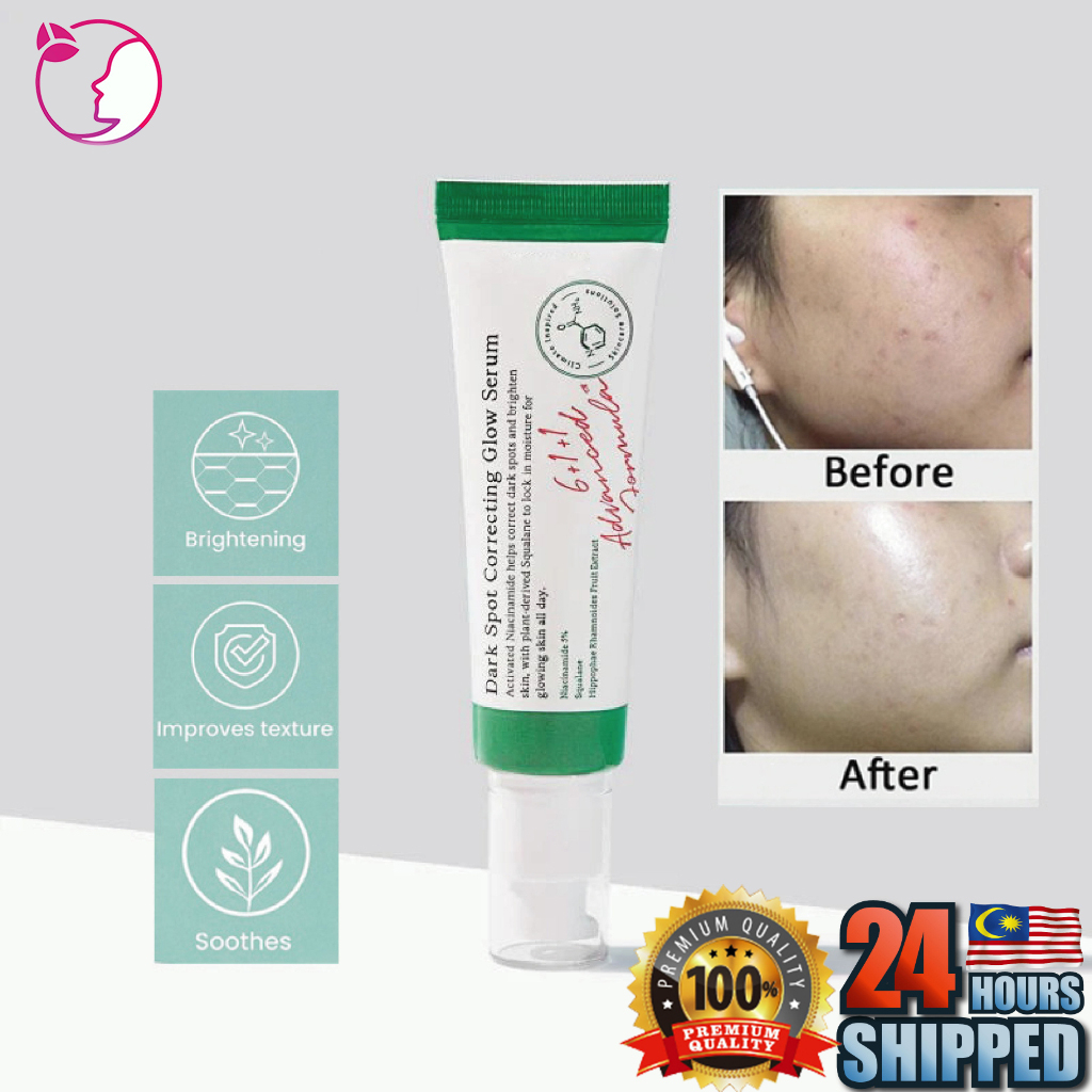 AXIS-Y Dark Spot Correcting Glow Serum 50ml Axis Y Axis Y Reduces ...