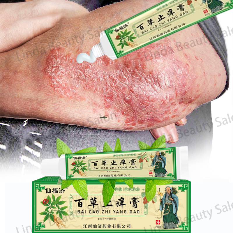 Psoriasis Cream Eczema Krim gatal ubat kulit eczema kurap dan Herbal ...