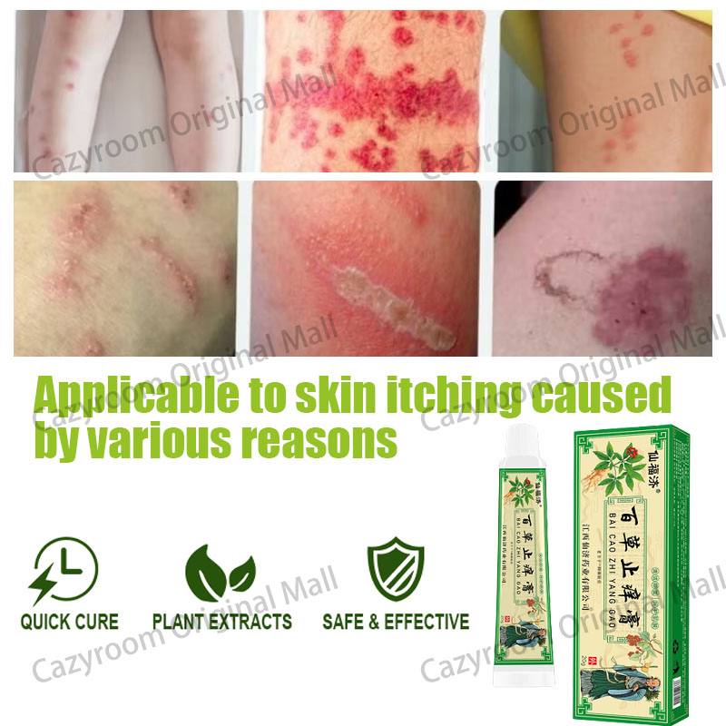 Krim gatal ubat gatal kulit eczema krim kurap dan gatal psoriasis cream ...