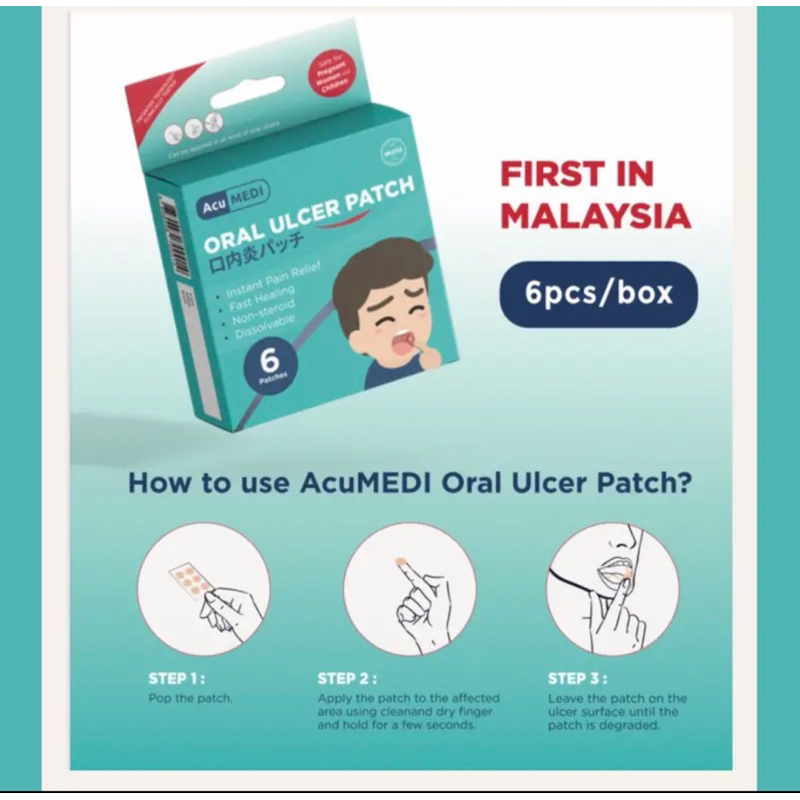 ORAL ULSER PATCH BY ACUMEDI | Shopee Malaysia
