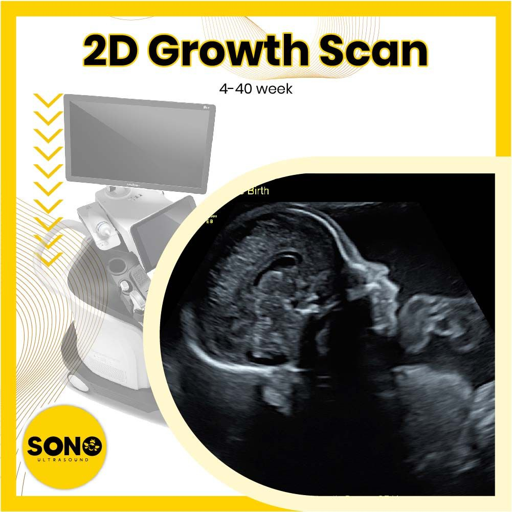 2D GROWTH SCAN (4-40 WEEK) | Shopee Malaysia