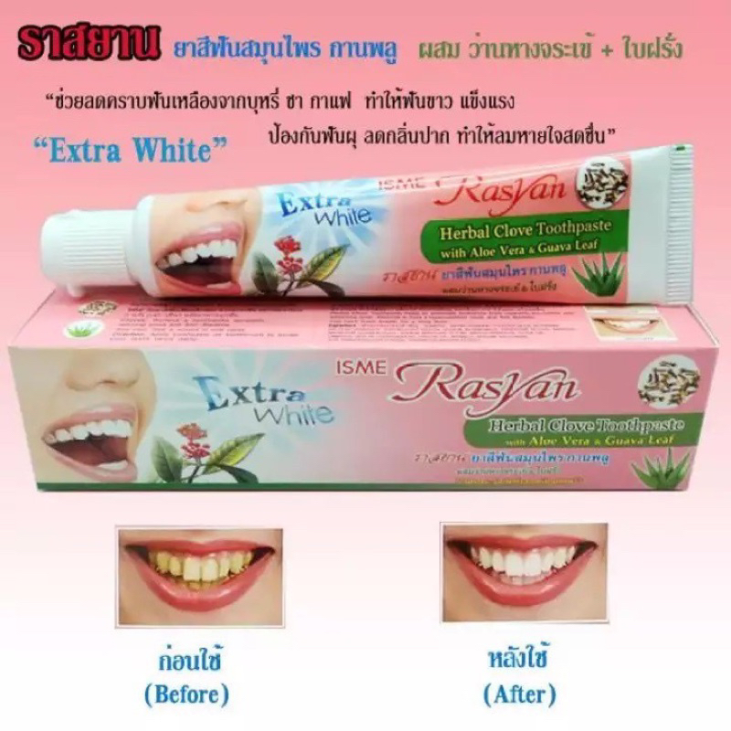 Rasyan Herbal Clove Toothpaste With Aloe Vera&Guava Leaf🔥🔥🔥 | Shopee ...