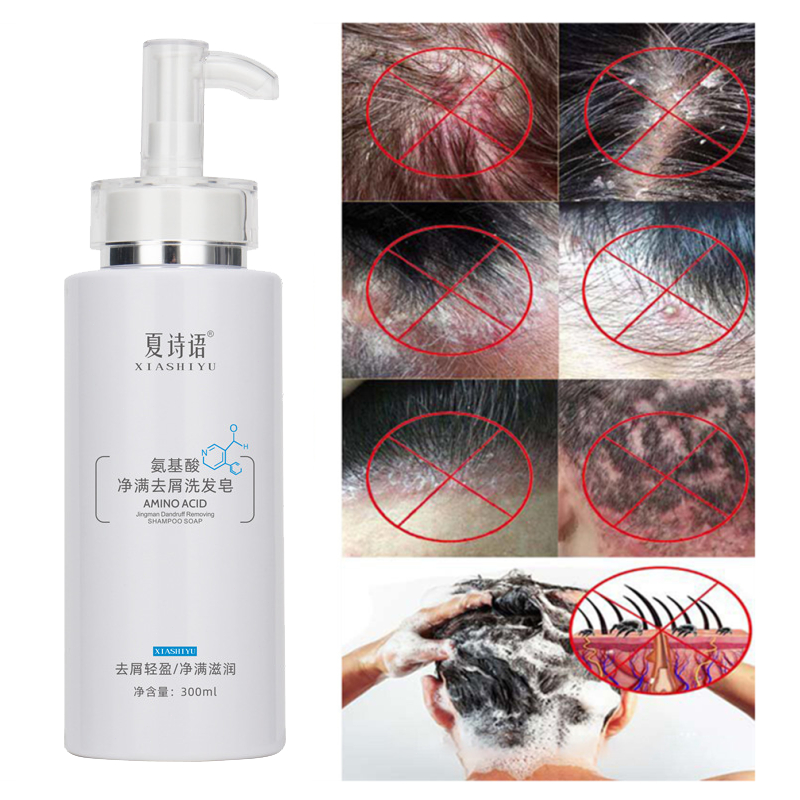 amino acid shampoo Anti Dandruff Oil Control Shampoo kelemumur rawat rambut kelemumur kulit ...