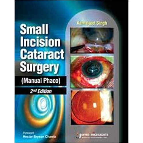 Small Incision Cataract Surgery (Manual Phaco) | Shopee Malaysia